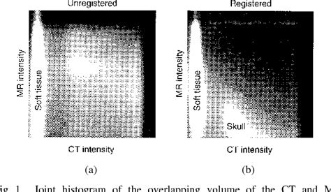 Figure 1 From Multimodality Image Registration By Maximization Of Mutual Information Semantic