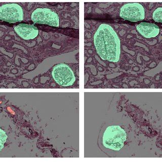 Left Semantic Segmentation Output Right After Morphological