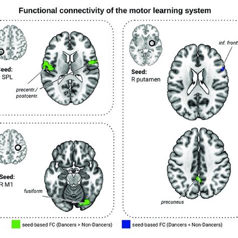 Functional Connectivity Differences Within The Motor Learning Network Download Scientific