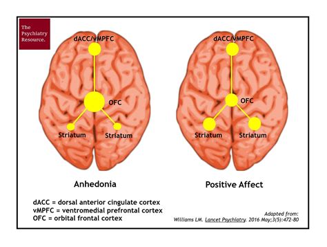 Major Depression Brain