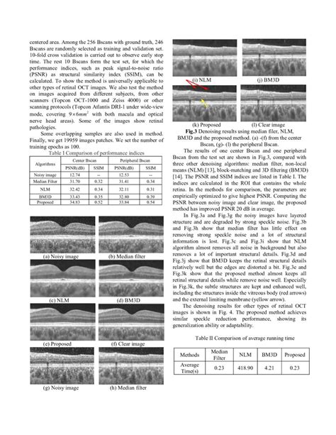 A Resnet Based Universal Method For Speckle Reduction In Optical Coherence Tomography Images