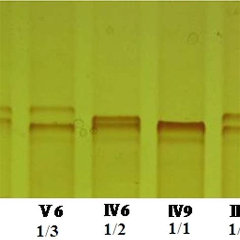 The Silver Staining Of 8 Denaturing Polyacrylamide Gel Illustrated The Download Scientific