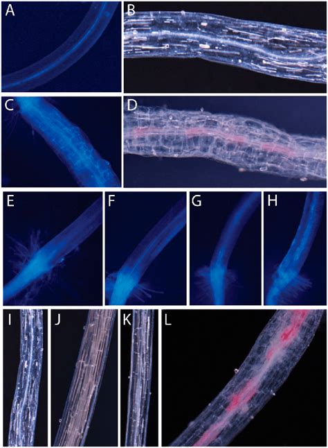 Fig S3 Hyper Accumulation Of Callose And Ectopic Lignin Production In