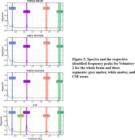 Characterization of pulsations in the brain and cerebrospinal fluid using ultra‐high field ...