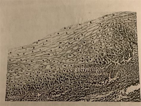 Stratified Squamous Diagram Quizlet