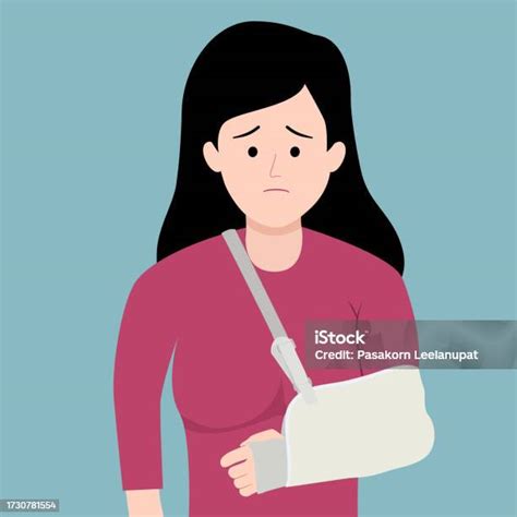 누군가의 신체 일부를 감싸는 파리의 석고로 만든 덮개를 손에 대고 부러진 뼈가 스스로 수리되는 동안 그들을 보호하기 위해 단단한 케이스를 형성합니다 부러진 팔에 대한 스톡