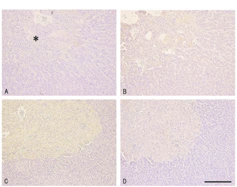 Immunohistochemical Localization Of Trkb Protein In Adrenal Tissue