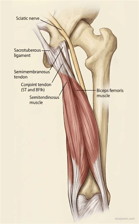 Proximal Hamstring Tendinopathy Diagnosis Management And Revision