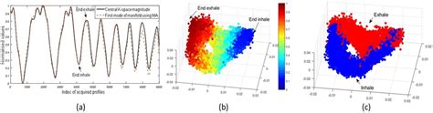 A The Magnitudes Of The Centre Of K Space For The 2d In Vivo Dataset