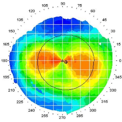 Corneal Topography — Niall Okane Optometrists