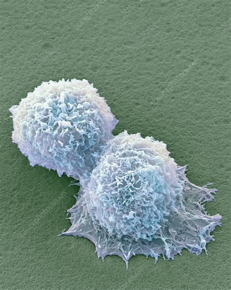 Sarcoma Cells Sem Stock Image M1320999 Science Photo Library