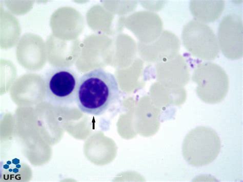 Hematologia Flashcards
