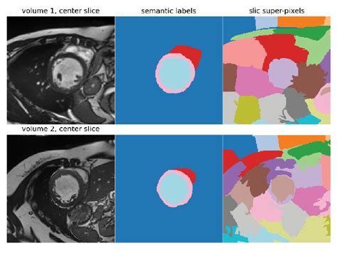 A Visual Example That Demonstrates The Shortcoming Of Existing Local