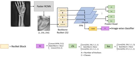 Scaphoid Fracture Detection By Using Convolutional Neural Network Pmc