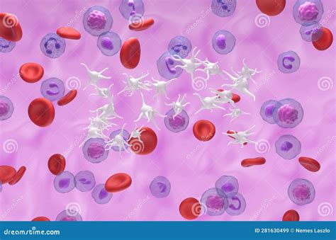 Essential Thrombocythemia Et Overproduction Of Platelets