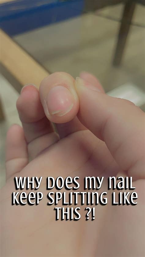 Nails Keep Splitting Horizontally And Idk How To Make It Stop R