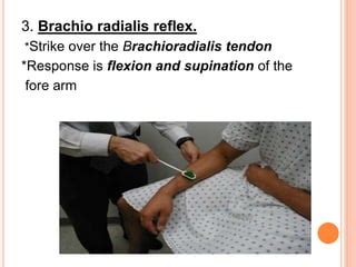 Neurological Assessment Pptx