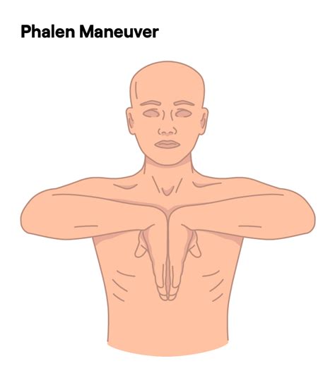 Phalen Maneuver For Carpal Tunnel A Key Diagnostic Tool