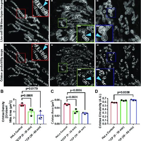 Trainable Weka Segmentation Protocol Can Segment Different Cristae Download Scientific Diagram