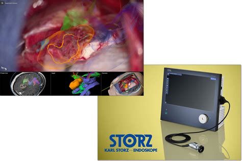 Arveo 8 Digital Visualization Microscope For Neurosurgery Products Leica Microsystems Arveo 8 Digital Visualization Microscope For Neurosurgery Products Leica Microsystems