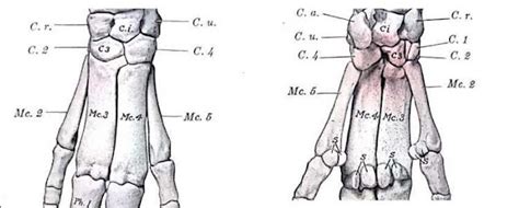 Bones Of Metacarpus Gross Anatomy Anjani Mishra