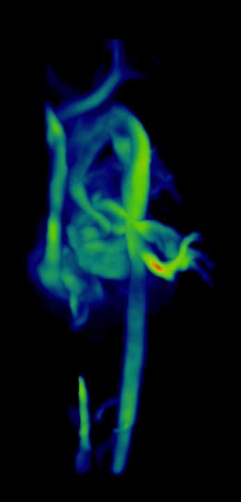 Fabrizio Ricci On Linkedin 4dflow Whycmr Tevar Multimodality