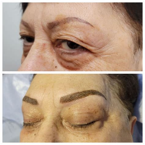 👉გაფუჭებული წარბის ესთეტიკ ცენტრი Aesthetic Centre