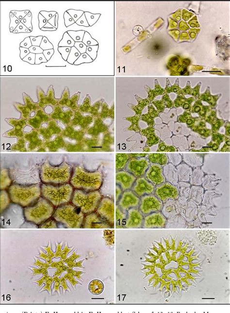 Figure 10 From Morphology And Taxonomy Of Some Rare Chlorococcalean Algae Chlorophyta