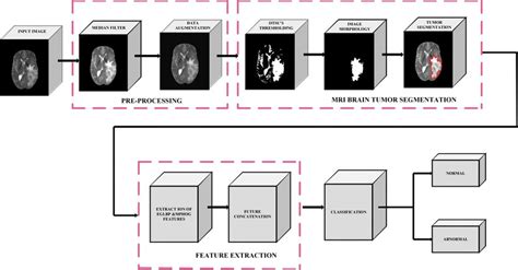 block diagram of proposed brain tumor identification and classification