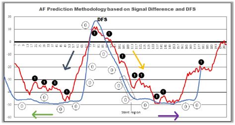 Atrial Fibrillation Prediction Using Signal Difference And Dfs Download Scientific Diagram