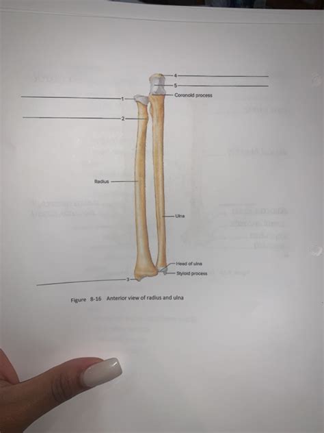 Solved Coronoid Process Radius Head Of Ulna Styloid Process