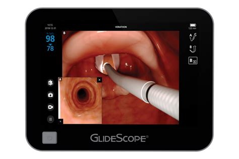 GlideScope Core Anandic