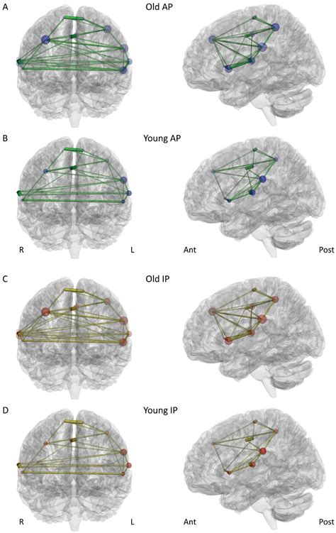 Visualization Of Key Functional Connectivity Metrics In Network N2