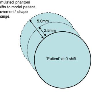Simulation Of Patient Setup Error Download Scientific Diagram