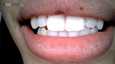 Beverlys Endoscope Mouth Tour With Audio 720 Hd Giantess Vore Oralvore Clips4sale