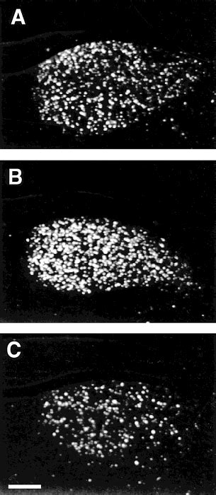 Loss Of Hvc Ra Projection Neurons Between Download Scientific Diagram