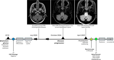 Analysis Of Cerebrospinal Fluid Tumor Derived Dna To Obviate Biopsy Of Idh Mutant Brainstem