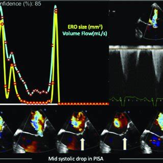 Representative Dynamic Flow Curve And Corresponding D Data In Primary Download Scientific