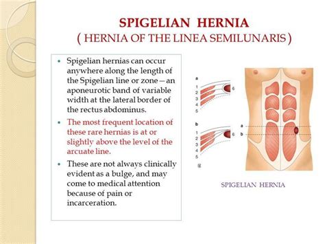 Spigelian Hernia Anatomy