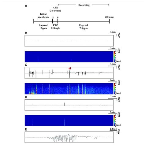 Experimental Protocols Used To Measure Eeg Signals And Representative Download Scientific