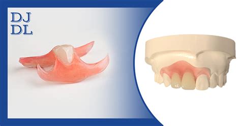 Nesbit Flexible Partial Denture Dental Lab Direct