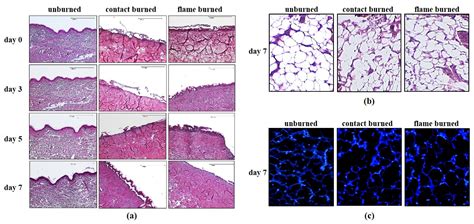 Experimental Study Of Burn Damage Progression In A Human Composite