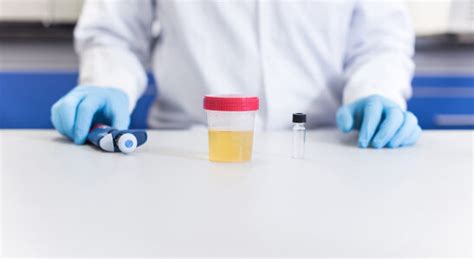 Décrypter Son Ecbu Comprendre Lanalyse Durine Et La Culture