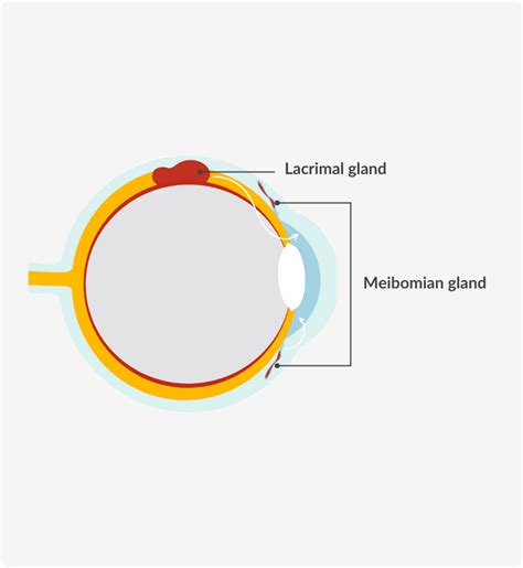 What Is Meibomian Gland Dysfunction Key Symptoms Causes And Treatments Vision Direct Au