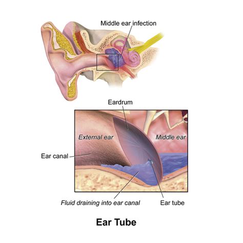 Ear Nose And Throat Coastal Ent