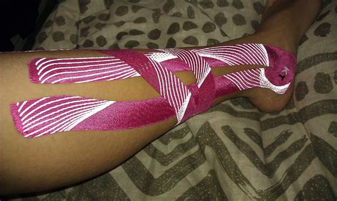 Using Kt Tape For Shin Splints At Adam Hebert Blog