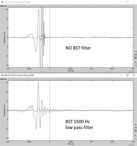 Filtering Issue In Abr Pre Processing Discussions Brainstorm