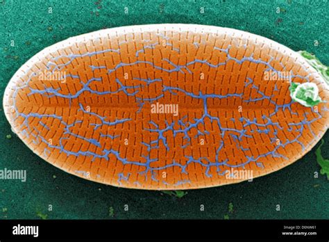 This Digitally Colorized Scanning Electron Micrograph SEM Untreated Water Specimen Extracted