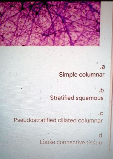 SOLVED A Simple Columnar B Stratified Squamous C Pseudostratified Ciliated Columnar D Loose