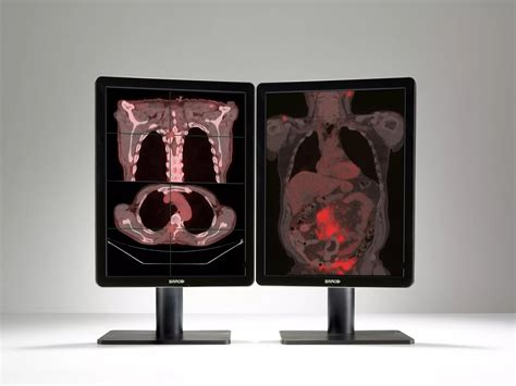 Healthcare Colour Matching On Diagnostic Displays Barco